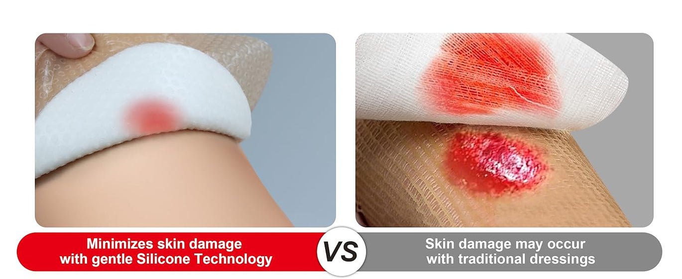 Silicone Foam Dressings | Silicone Dressings for Wounds – FRESINIDER ...